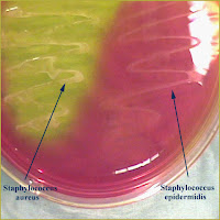 Biochemical Testing: MSA (Mannitol Salt Agar)